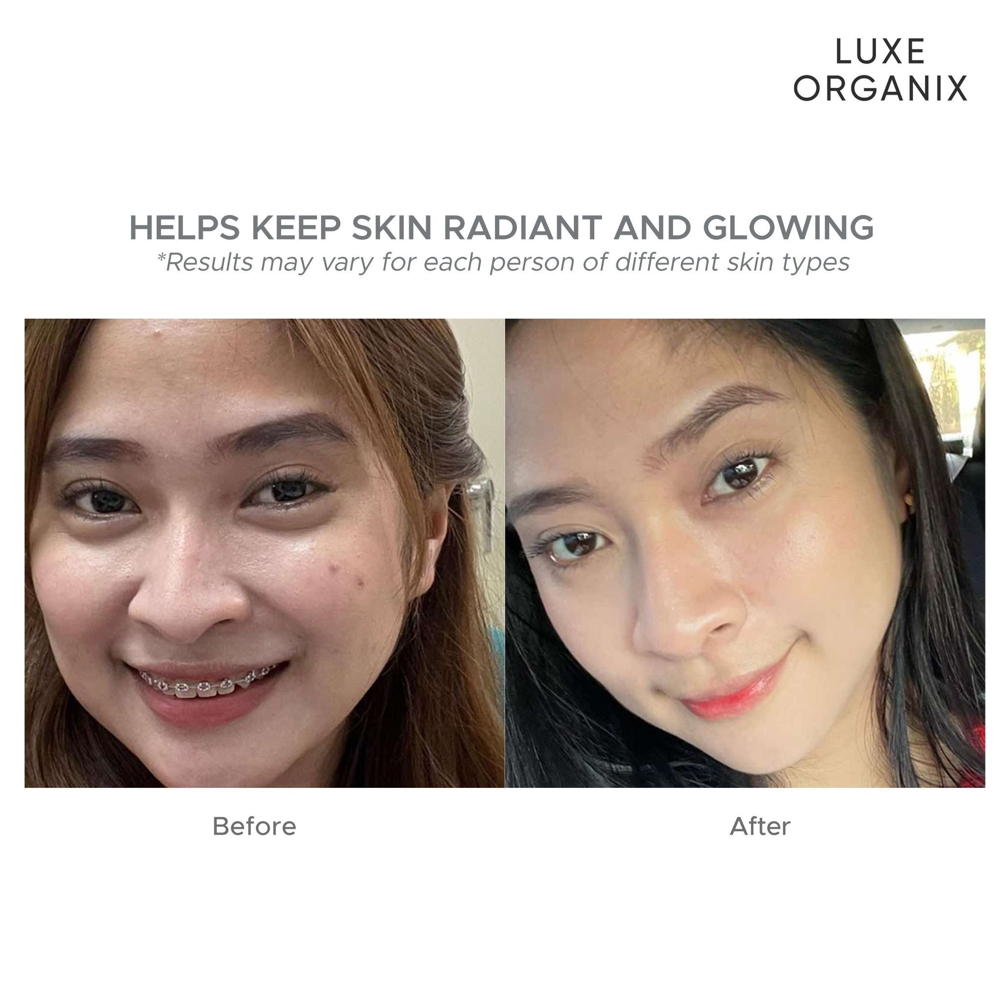 LUXE ORGANIX, Power Glow Vita Glow C Serum 7ml | Watsons Philippines