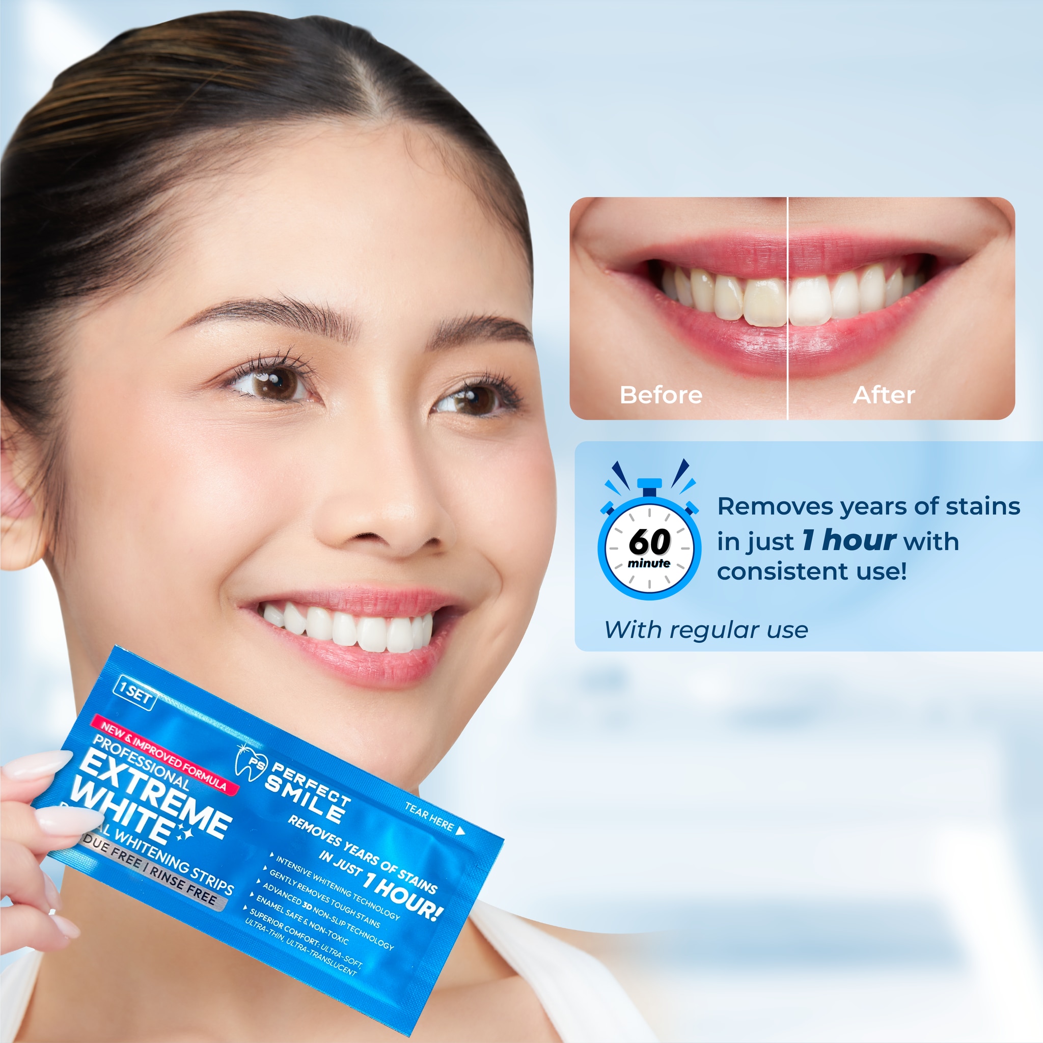 PERFECT SMILE, PERFECT SMILE Professional Extreme White Teeth Whitening ...